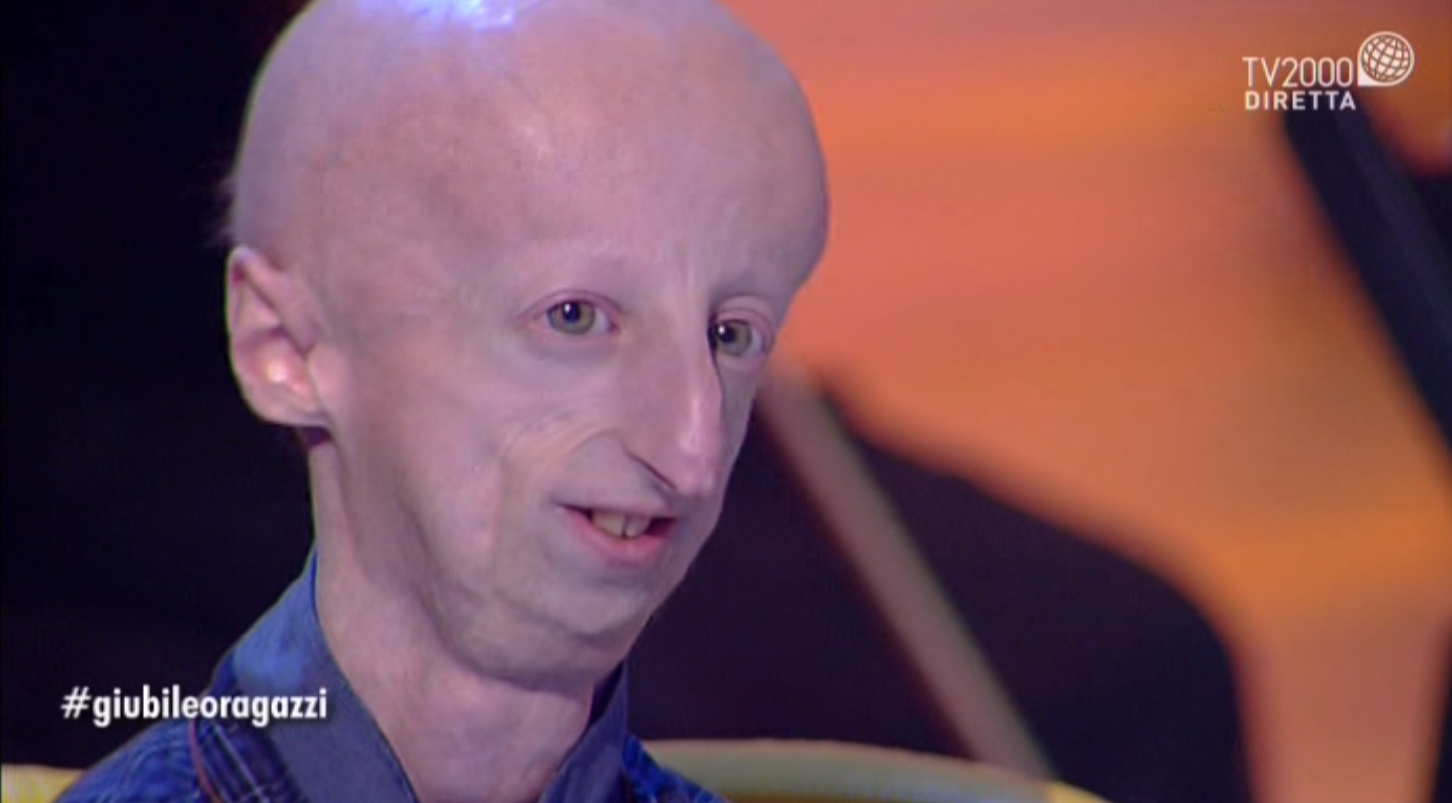 #GiubileoRagazzi La testimonianza di Sammy Basso e dei suoi genitori ...